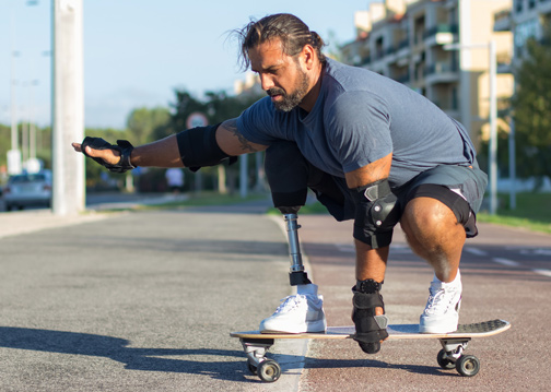Prothesen - Orthopädie-Technik Kächele GmbH